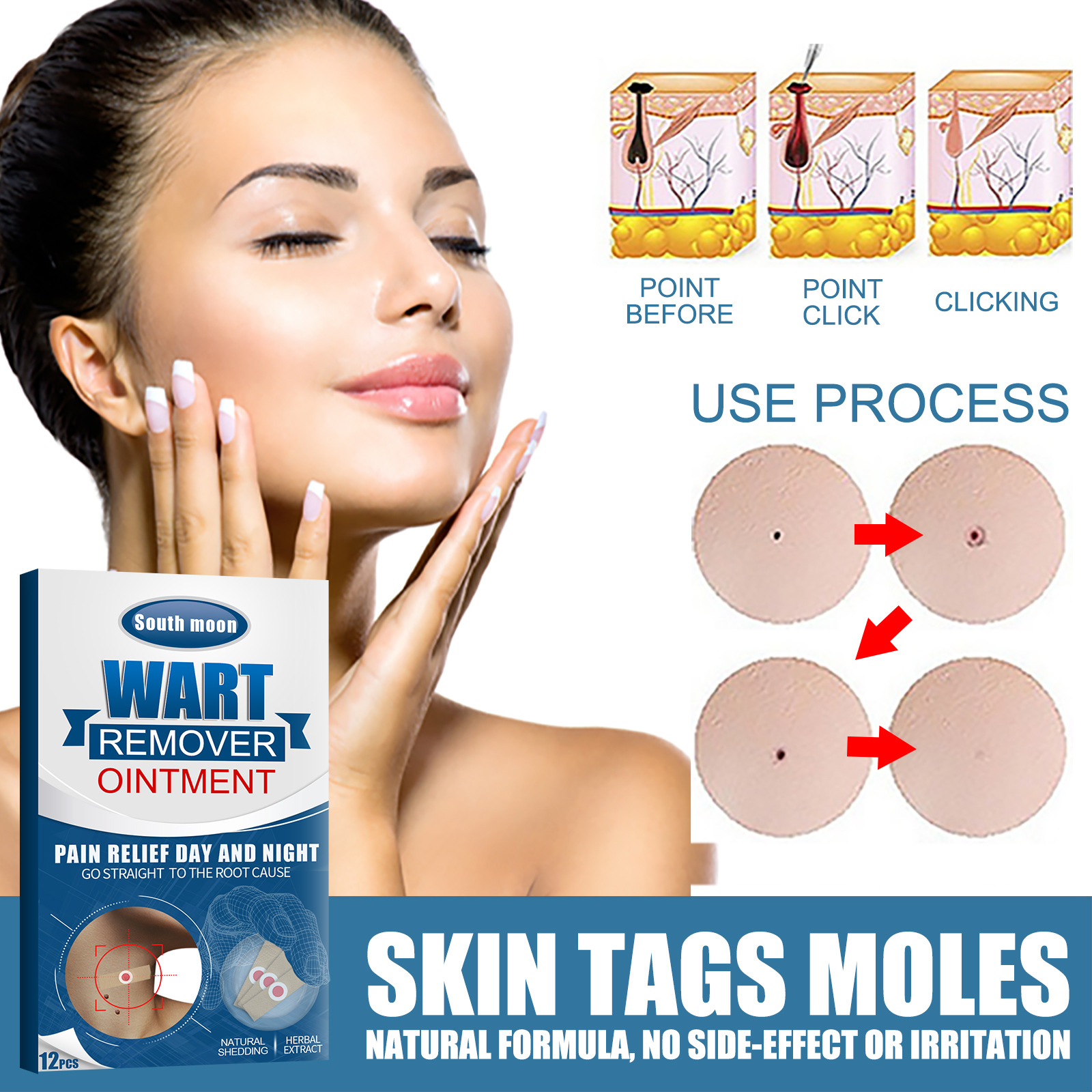 Best price for New Warts Remover Ointment Wart Treatment Cream Skin Tag ...