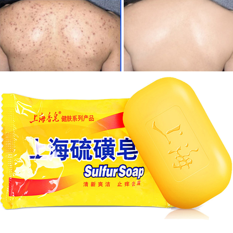 Best price for 85g Shanghai Sulfur Soap Oil-Control Acne Treatment ...